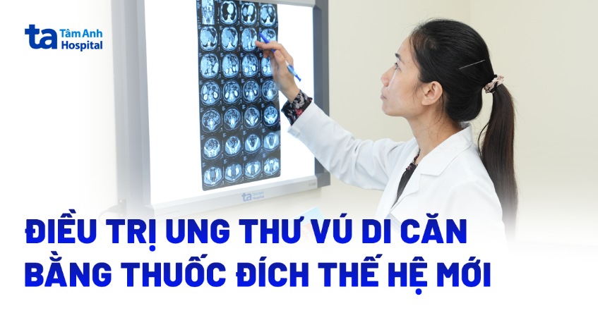 Điều trị ung thư vú di căn bằng thuốc đích thế hệ mới