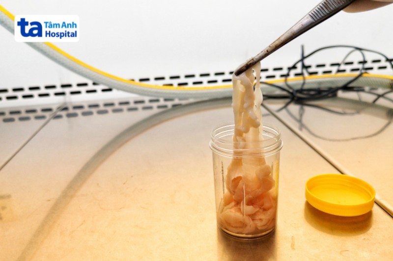 Thông tin về sán dây bò qua hình ảnh và vòng đời